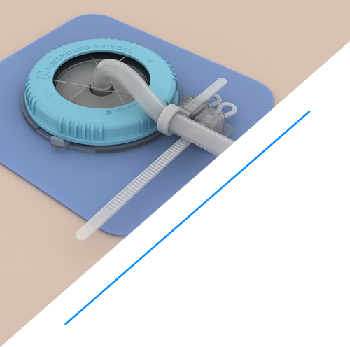 LOOPIX Wound Drainage Tube Fixing Device - Haichuang Medical