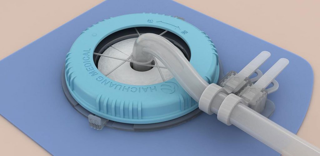 LOOPIX Wound Drainage Tube Fixing Device 2 - Haichuang Medical