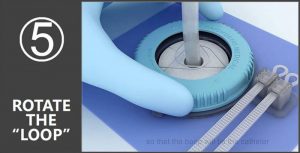 How to Use LOOPIX Wound Drainage Tube Fixing Device - Haichuang Medical