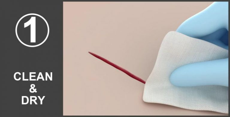 How to Use BI-FIX Surgical Incision Closure Set - Haichuang Medical