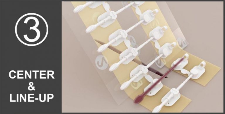 How to Use BI-FIX Surgical Incision Closure Set - Haichuang Medical