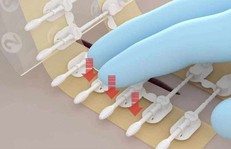 How to Use BI-FIX Surgical Incision Closure Set - Haichuang Medical