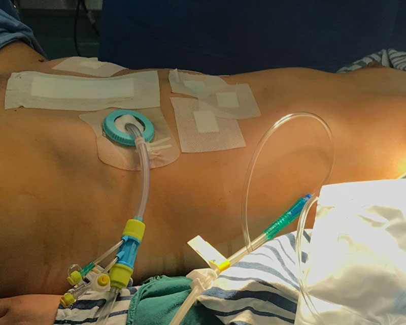 LOOPIX Landing Page #2310 - Haichuang Medical