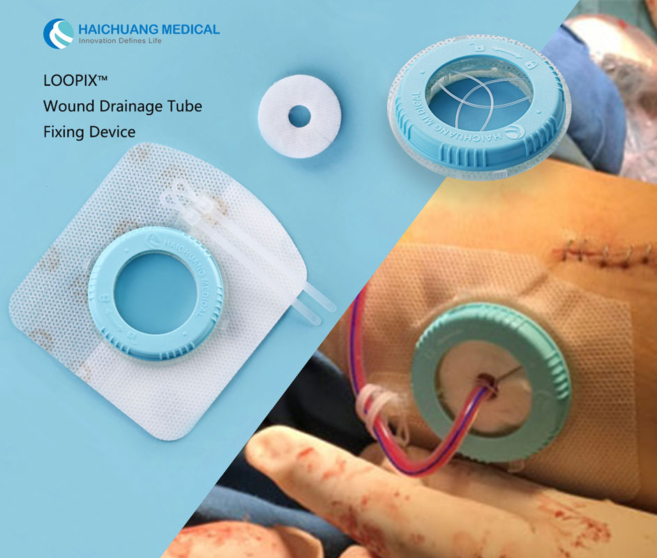 How does LOOPIX contribute to cost-effectiveness in healthcare ...