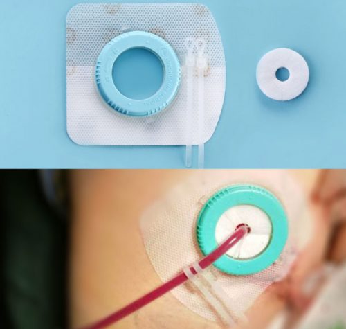 Haichuang Medical - Innovation Defines Life